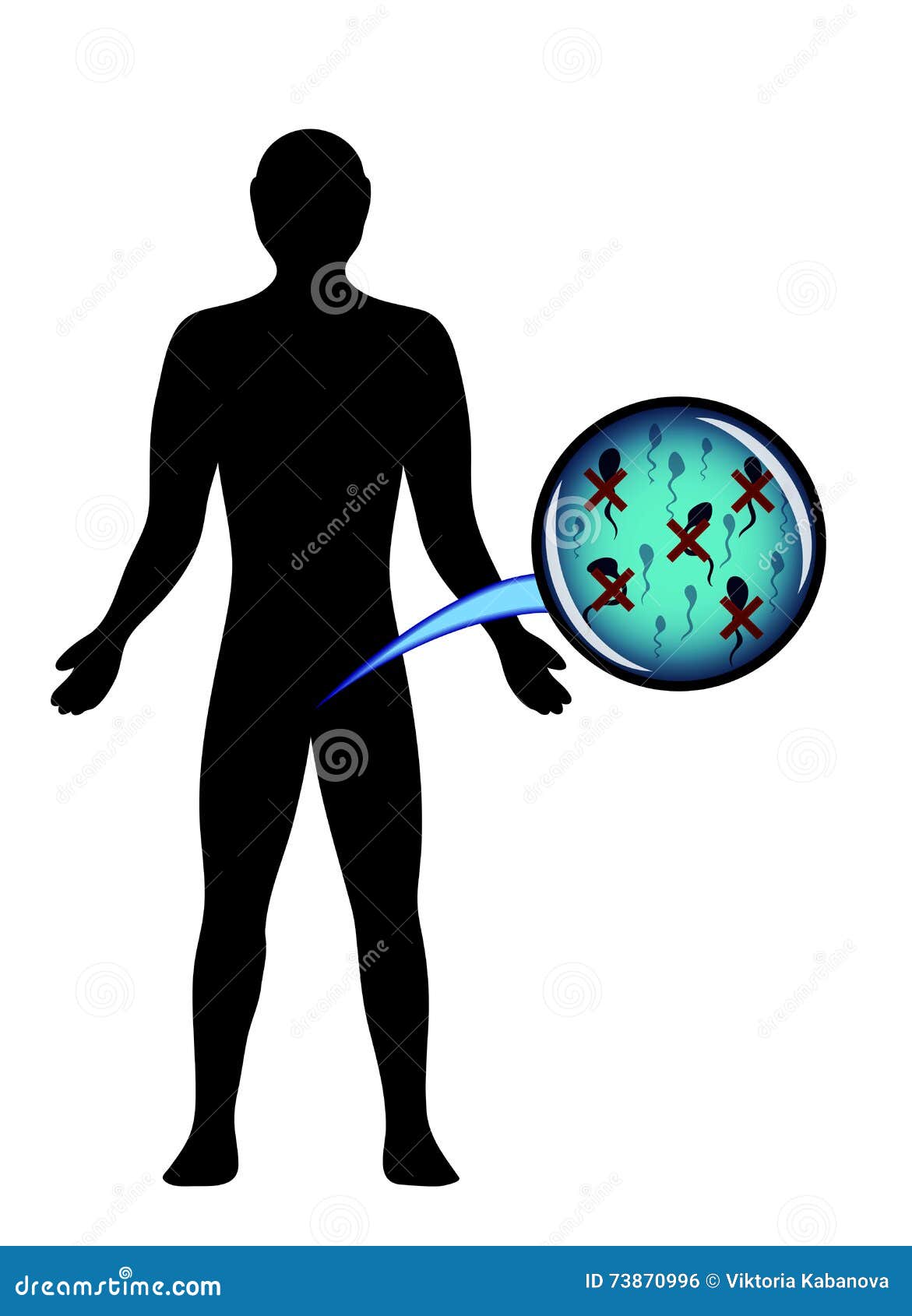 Male infertility stock vector. Illustration of insemination - 73870996