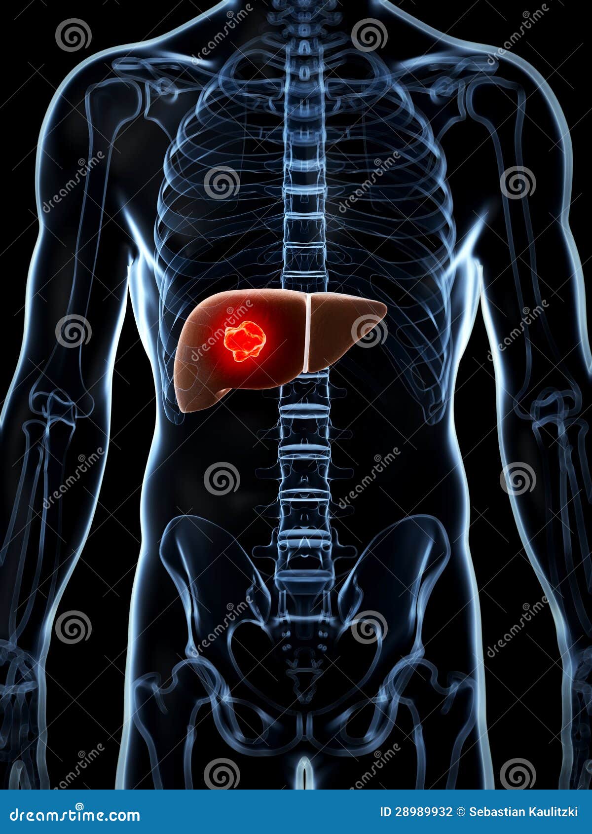 Liver - Male Anatomy Of Human Organs - X-ray View Stock Photo ...