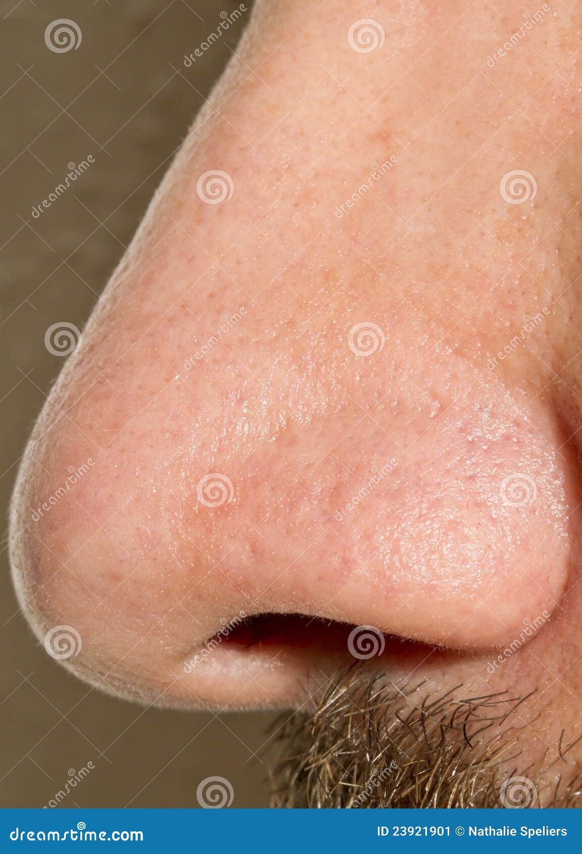 Male Nose Macro stock image. Image of comedones, comedo - 23921901