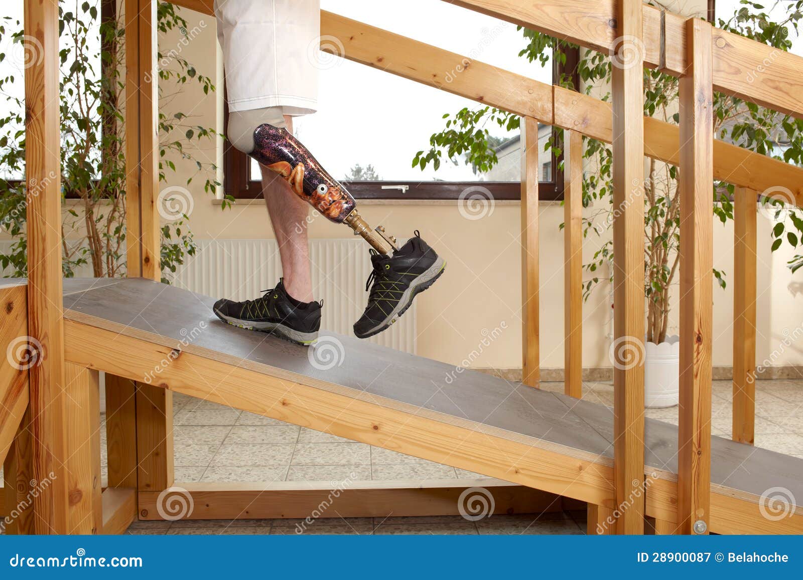 Male Prosthesis Wearer Training To Walk Uphill Stock Image - Image of ...