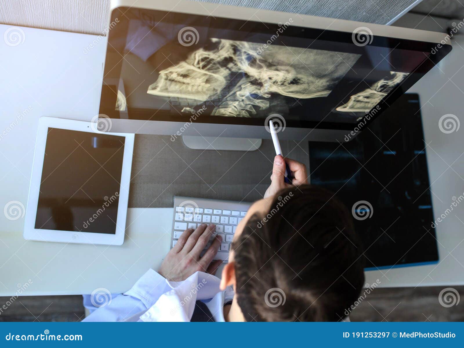 Male Radiologist Examining Neck X-rays Cervical Vertebrae on Computer ...