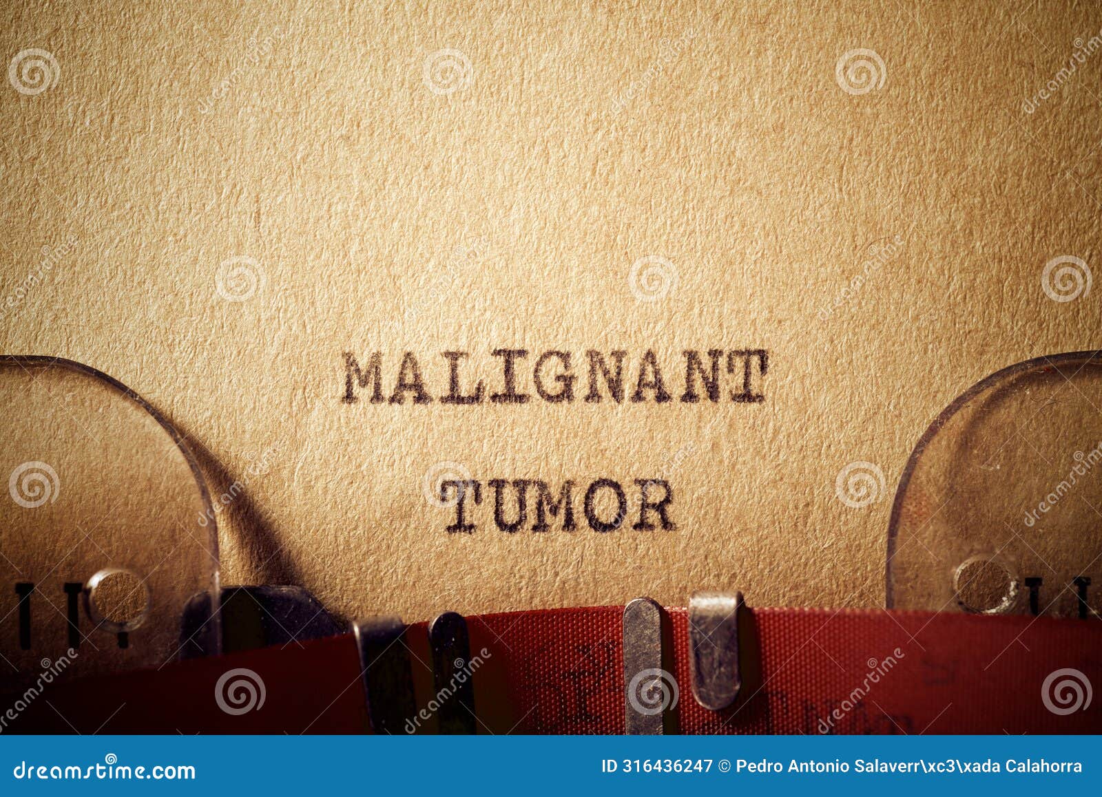 Malignant tumor phrase stock image. Image of malign - 316436247
