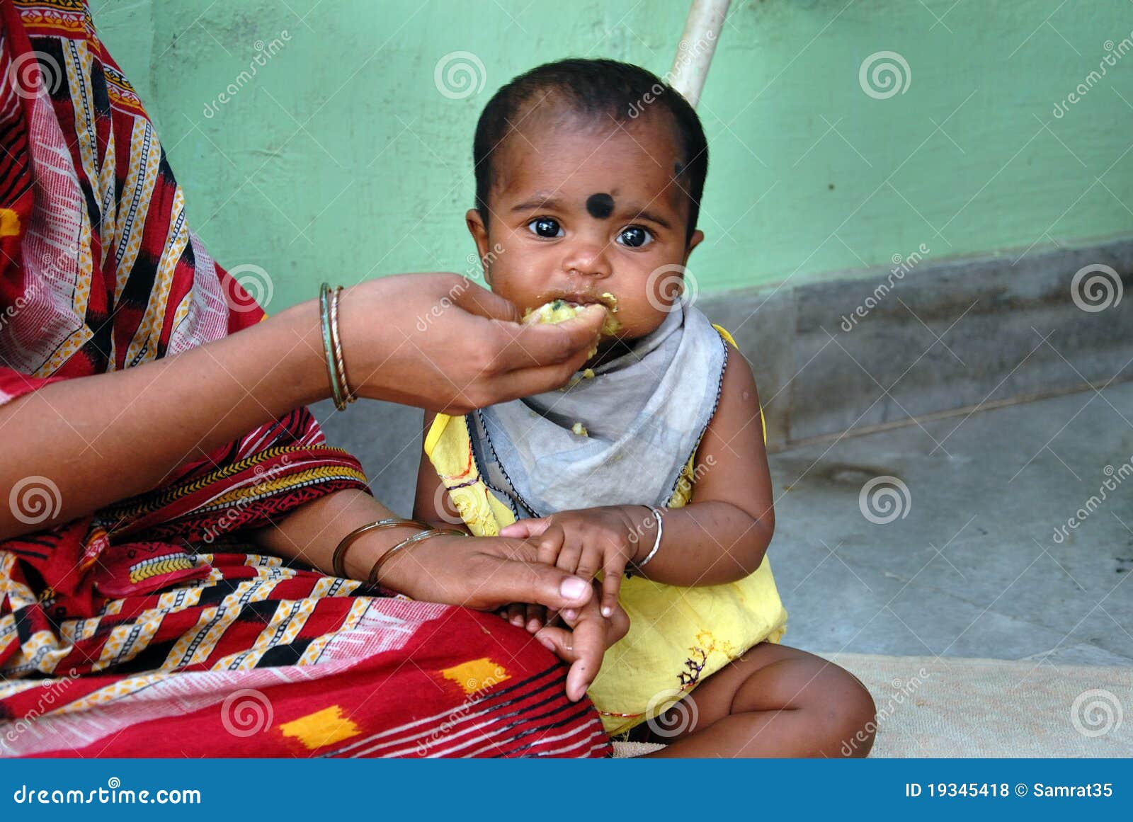 Malnourished Children in India Editorial Stock Photo - Image of people ...