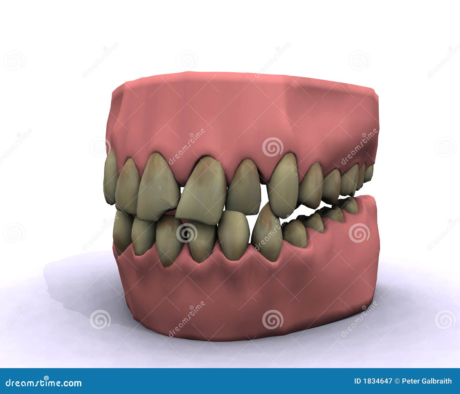 Malos Dientes De La Higiene Stock de ilustración - Ilustración de oral ...