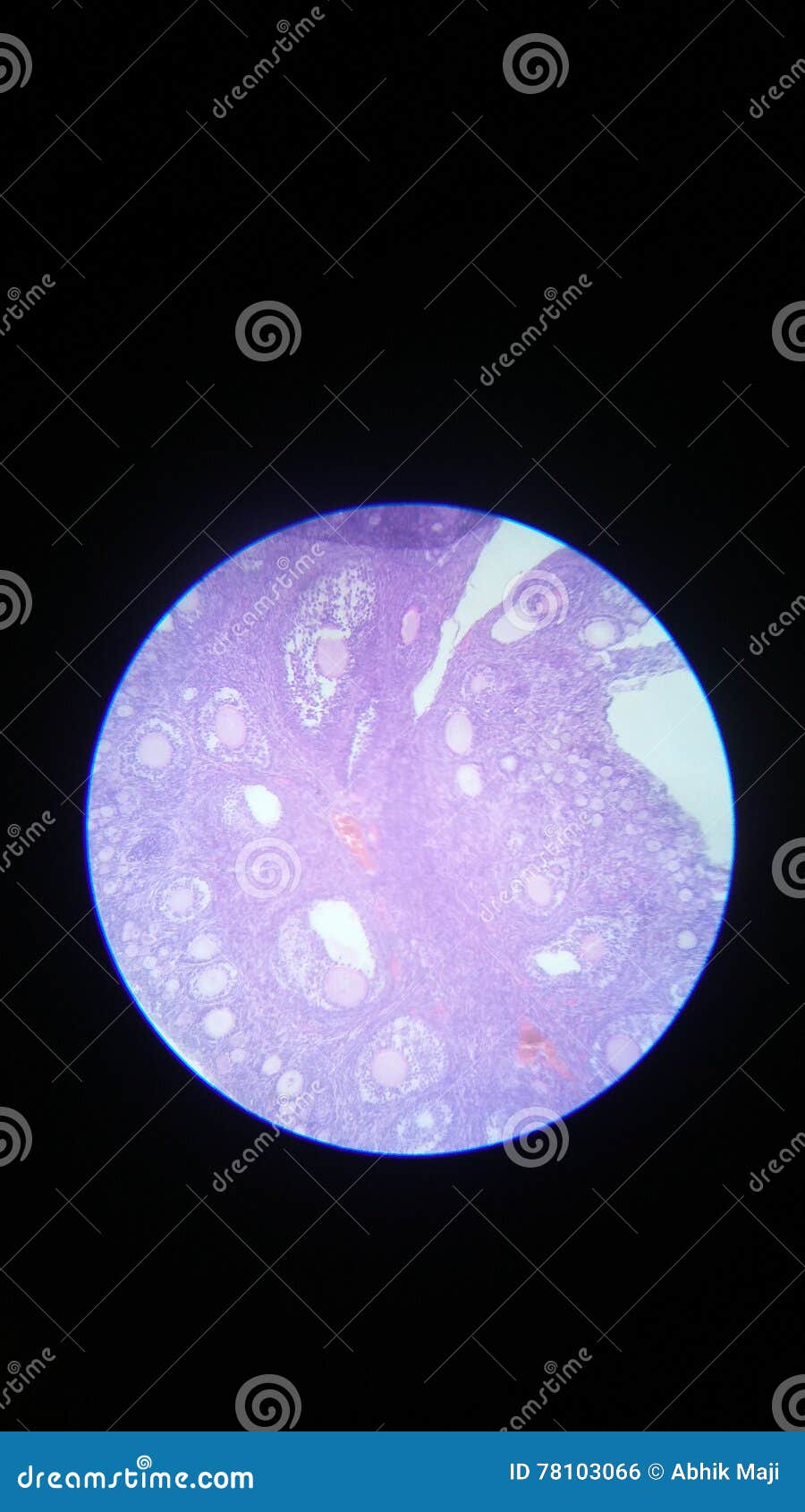 Mammalian ovary stock photo. Image of mammalian, microscope - 78103066