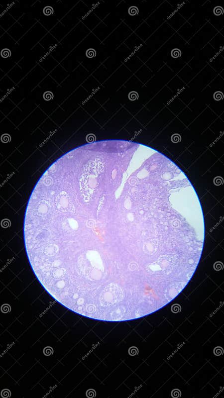 Mammalian ovary stock photo. Image of mammalian, microscope - 78103066
