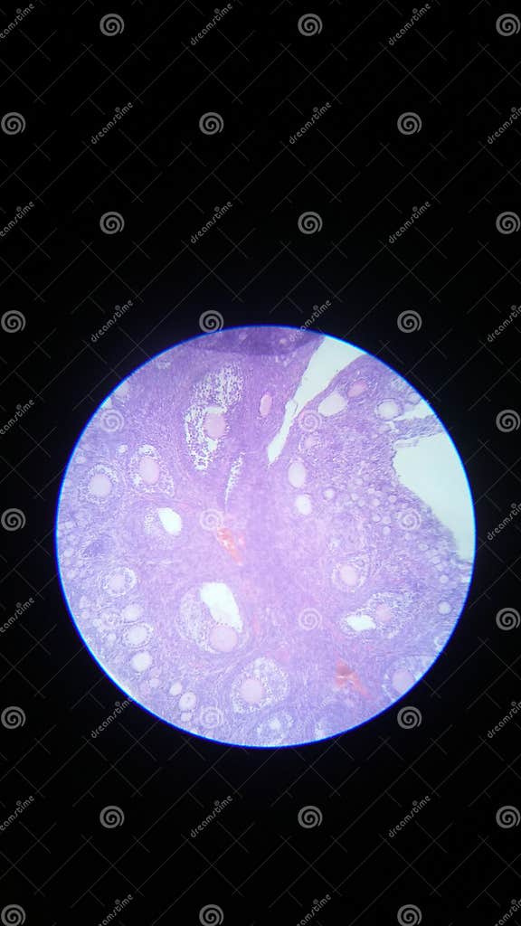 Mammalian ovary stock photo. Image of mammalian, microscope - 78103066