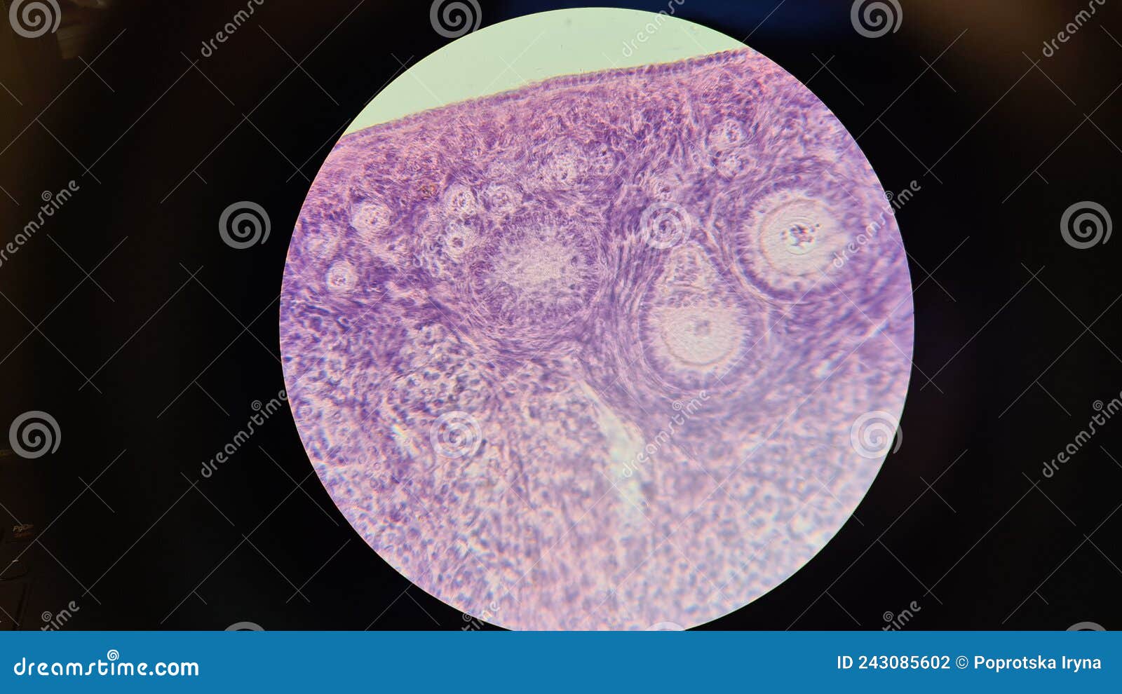 Mammalian Ovary Under a Microscope Stock Photo - Image of follicles ...