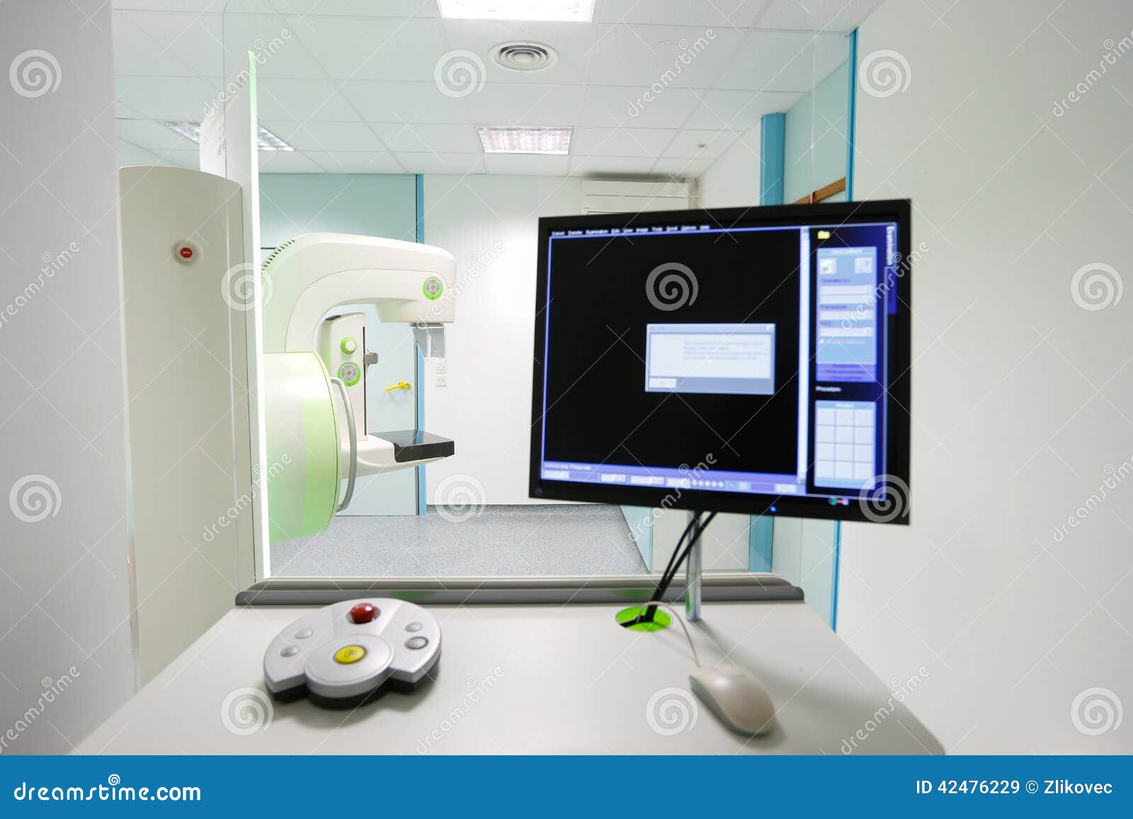 Mammography Breast Screening Machine Stock Image - Image of dose ...