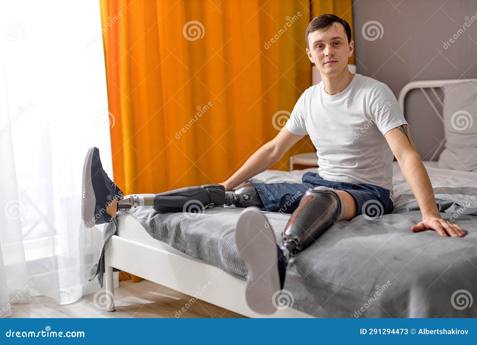 Amputee Man Sitting On A Stool, Prosthetic Leg Out, Hands On Head ...