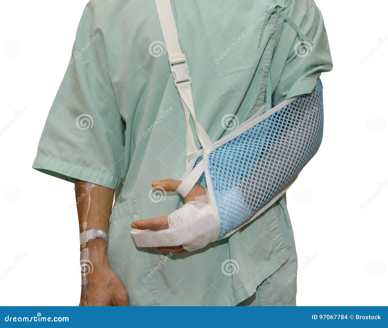 Man with an arm in plaster stock photo. Image of bone - 97067784
