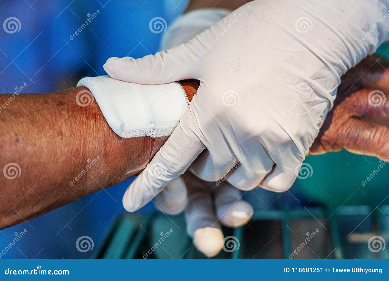 Man arm wound stock image. Image of medical, bleeding - 118601251