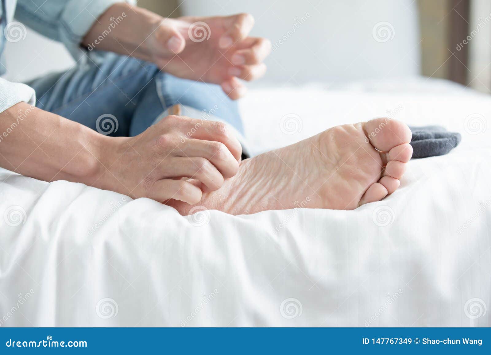 Man with athlete foot stock image. Image of eczema, hong - 147767349