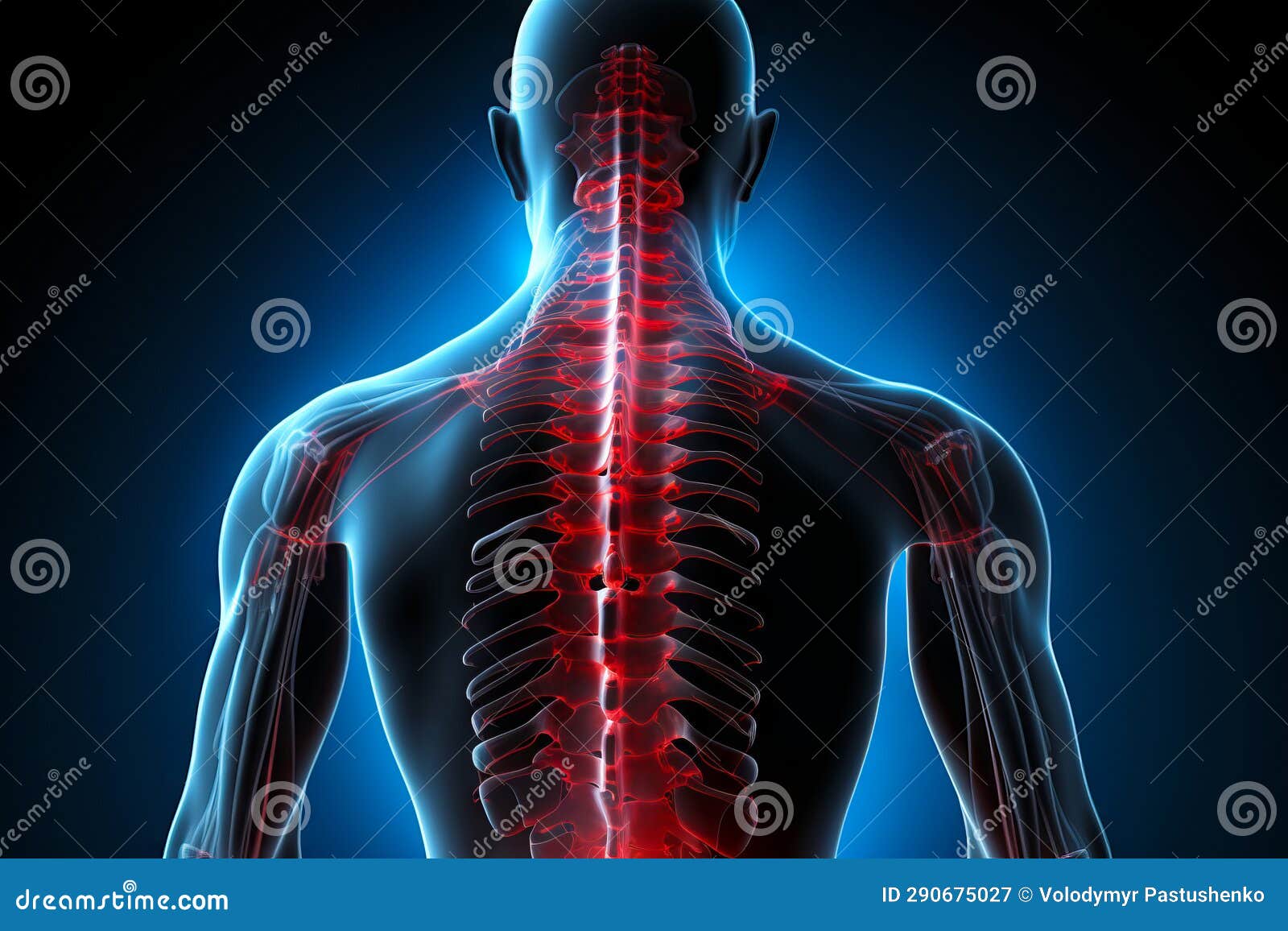 Man with Back Pain Highlighted in Red and Blue. Generative AI Stock ...