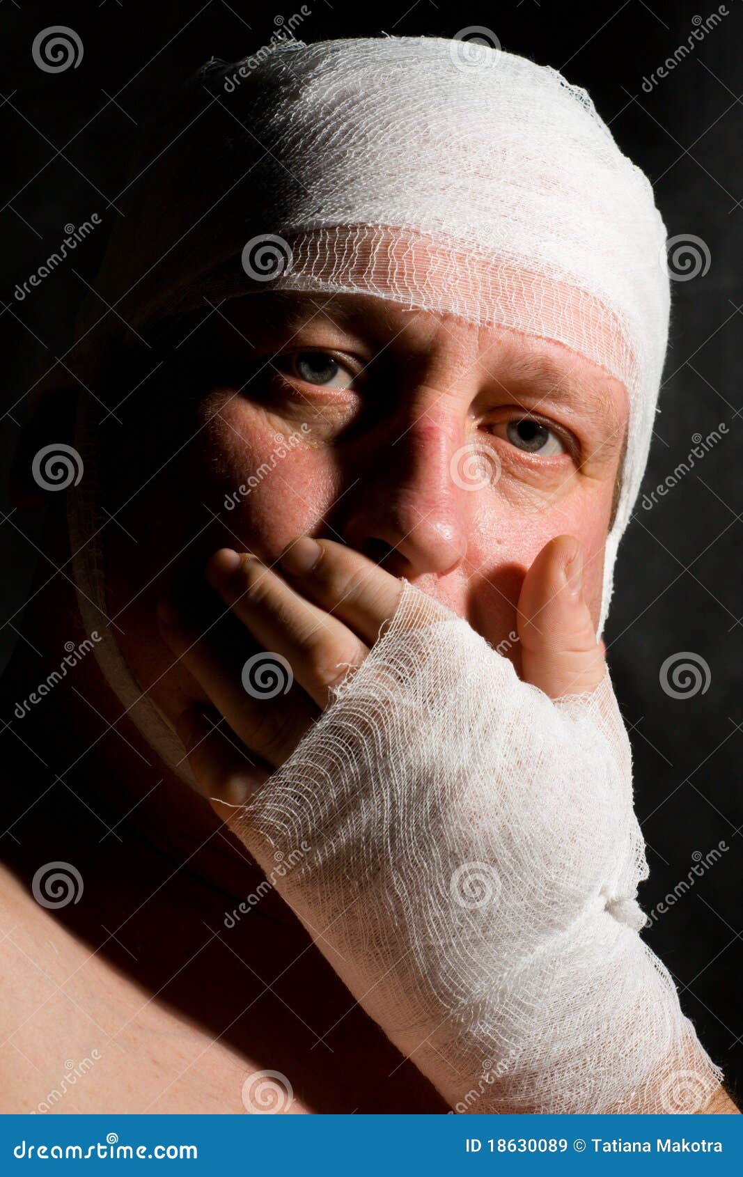 Man with bandage on head stock image. Image of damaged - 18630089