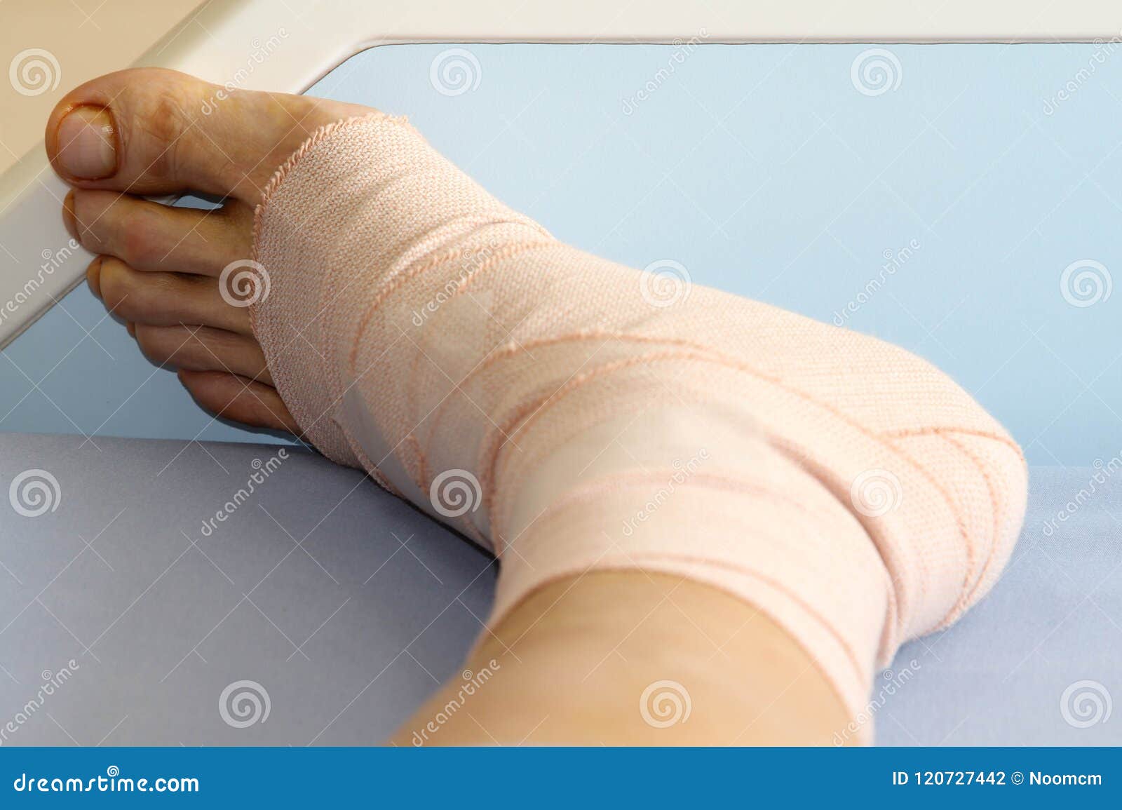Man with bandaged leg stock photo. Image of ankle, closeup - 120727442
