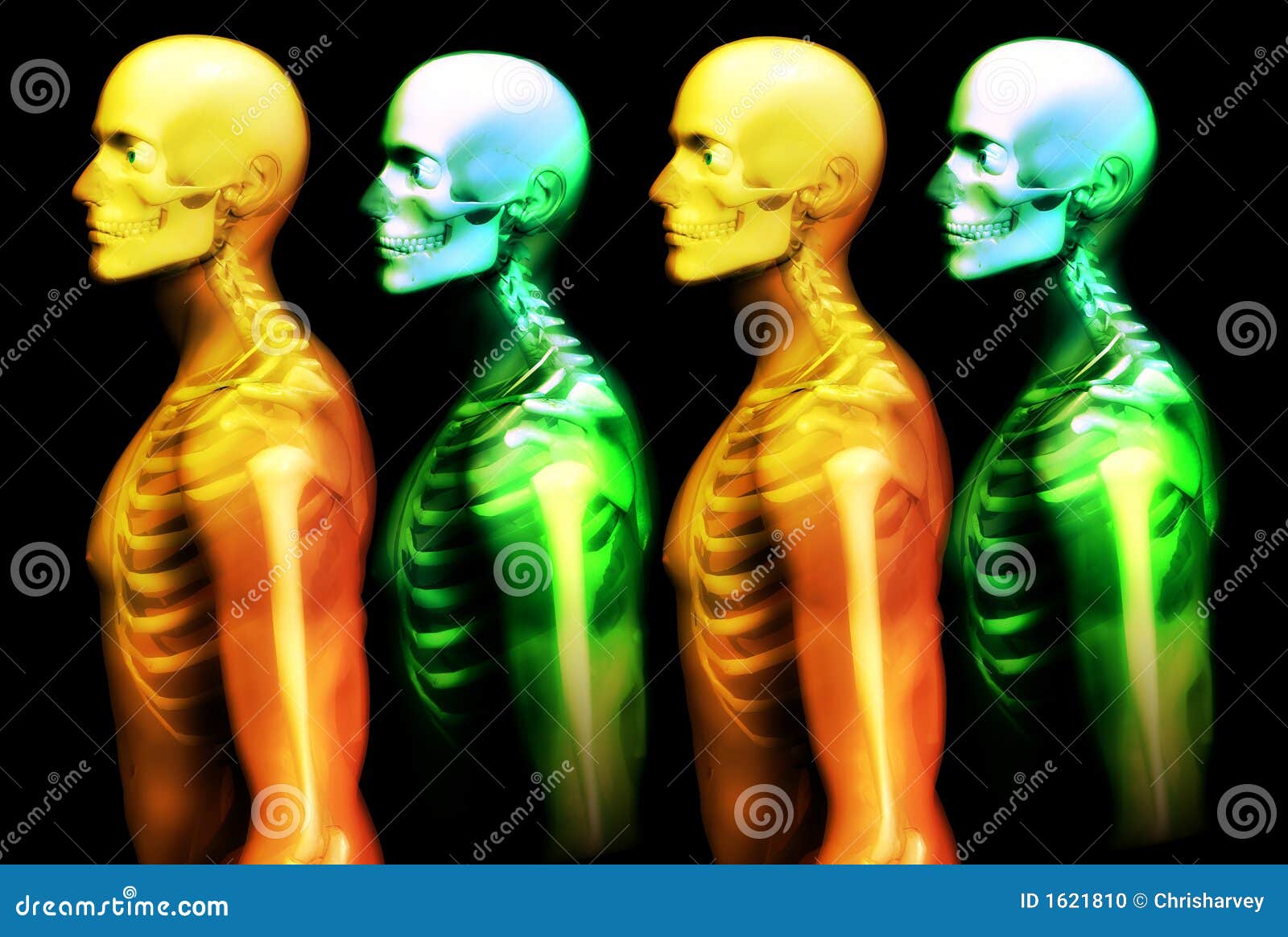 Skeletal Corpse Of A Man Lying On The Stones Isolated On White ...