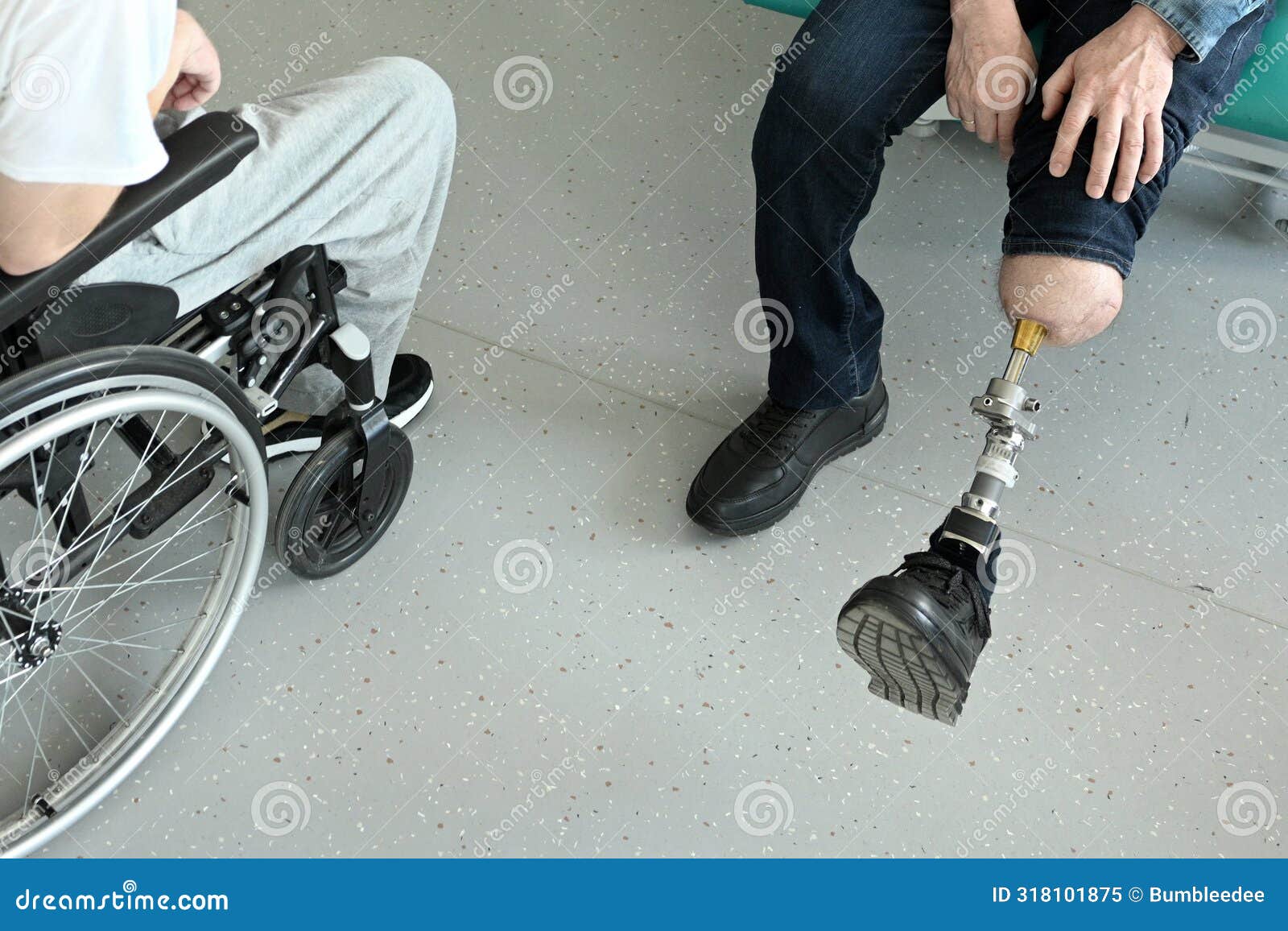 A Man with Bone-implanted Leg Prostheses. Osteointegration Stock Image ...
