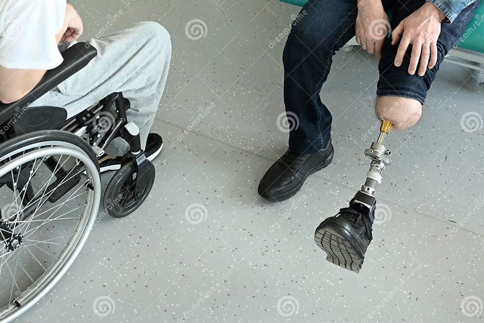 A Man with Bone-implanted Leg Prostheses. Osteointegration Stock Image ...