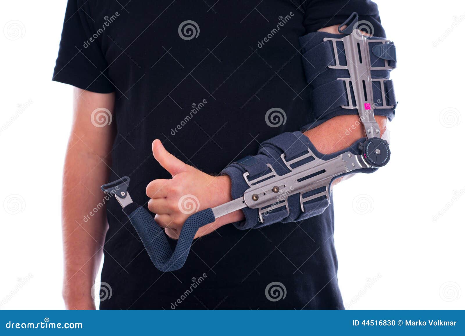 Man with broken arm stock photo. Image of emergency, hand - 44516830