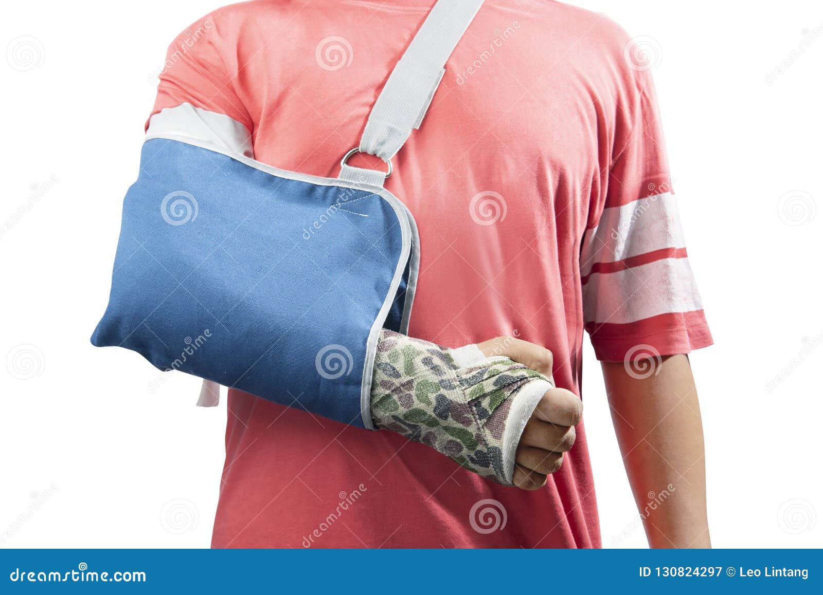 Broken Arm Arm Sling Therapy Support And Covered Around Elbow First Knuckle Broken Arm Stock