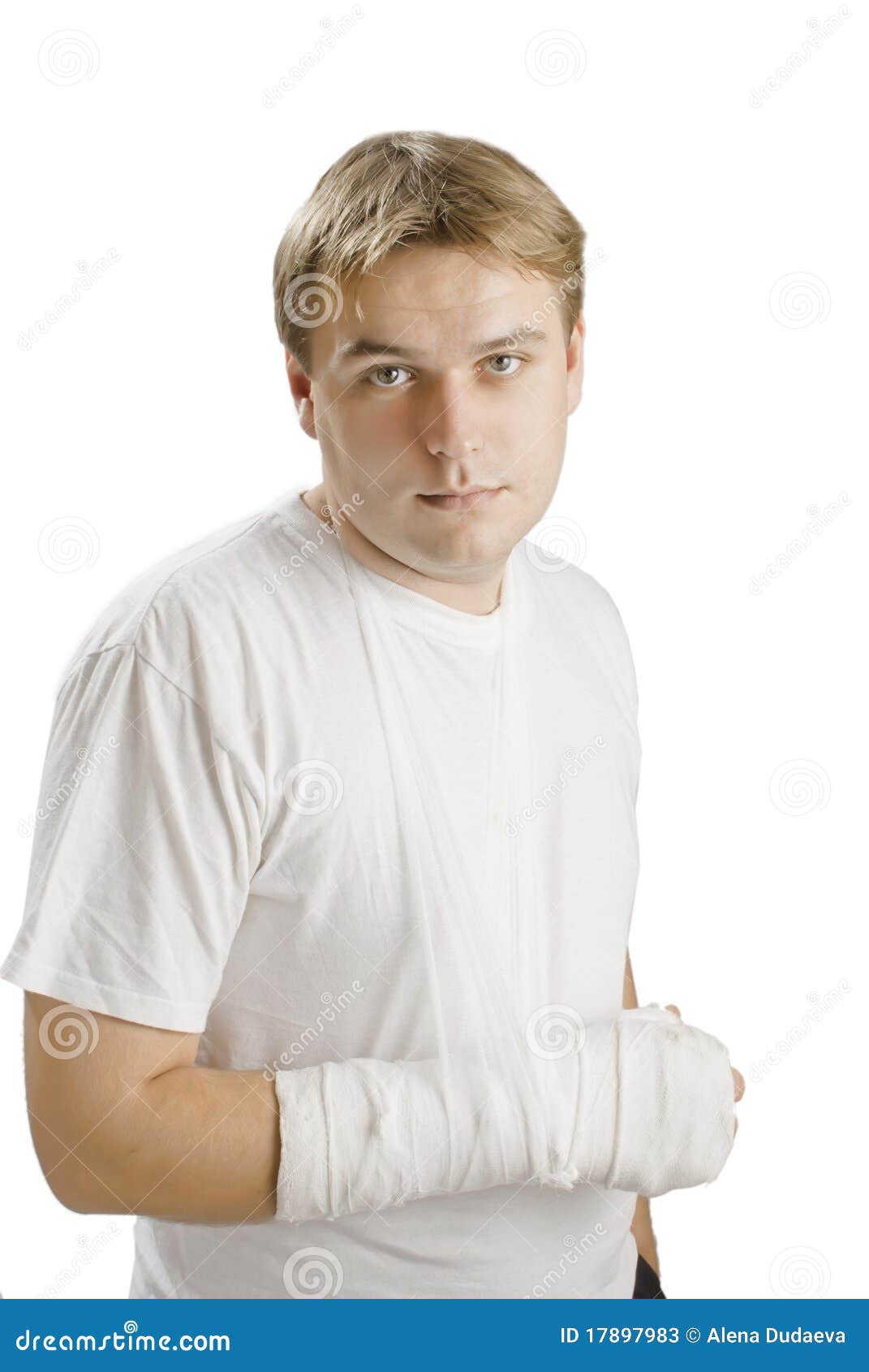 Man with a broken hand stock image. Image of wrist, grief - 17897983