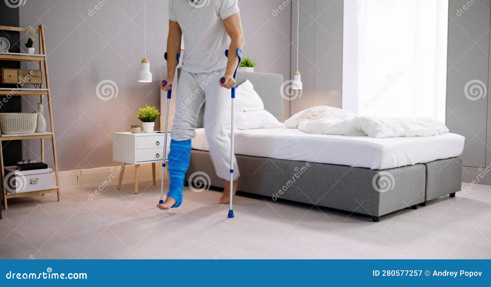 Man with Broken Leg after Accident Stock Image - Image of protect, room ...