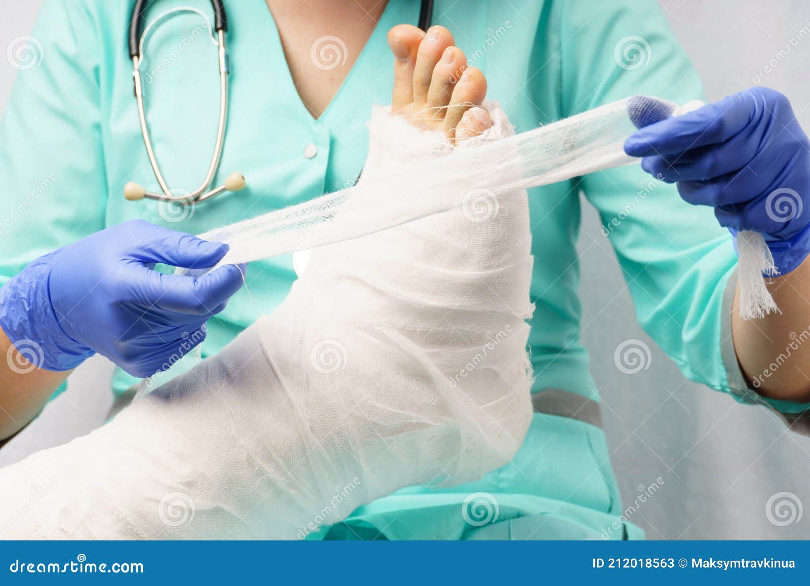 A Man with a Broken Leg at the Doctor`s Appointment Stock Image - Image ...