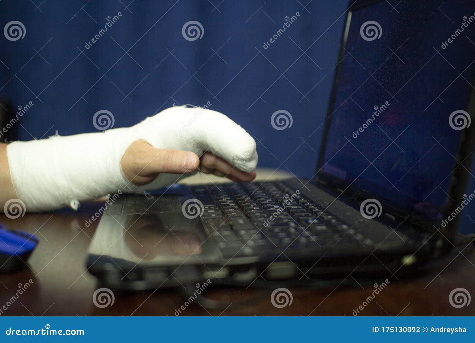A Man with a Cast on His Arm is Working at a Computer Stock Photo ...