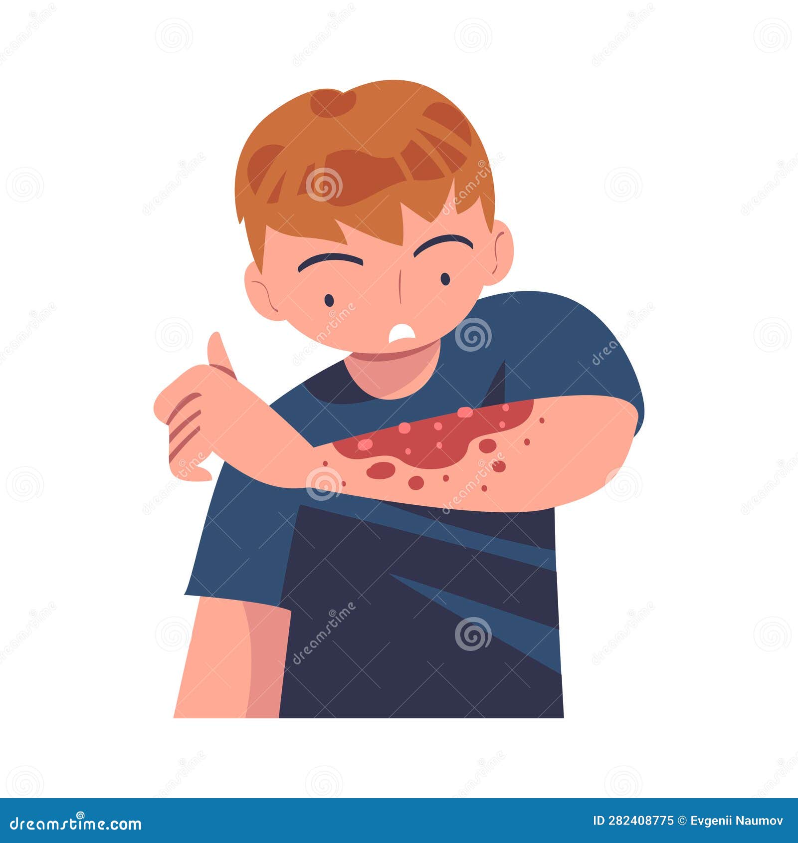 Man Character with Skin Problem Suffering from Itching Arm Vector ...
