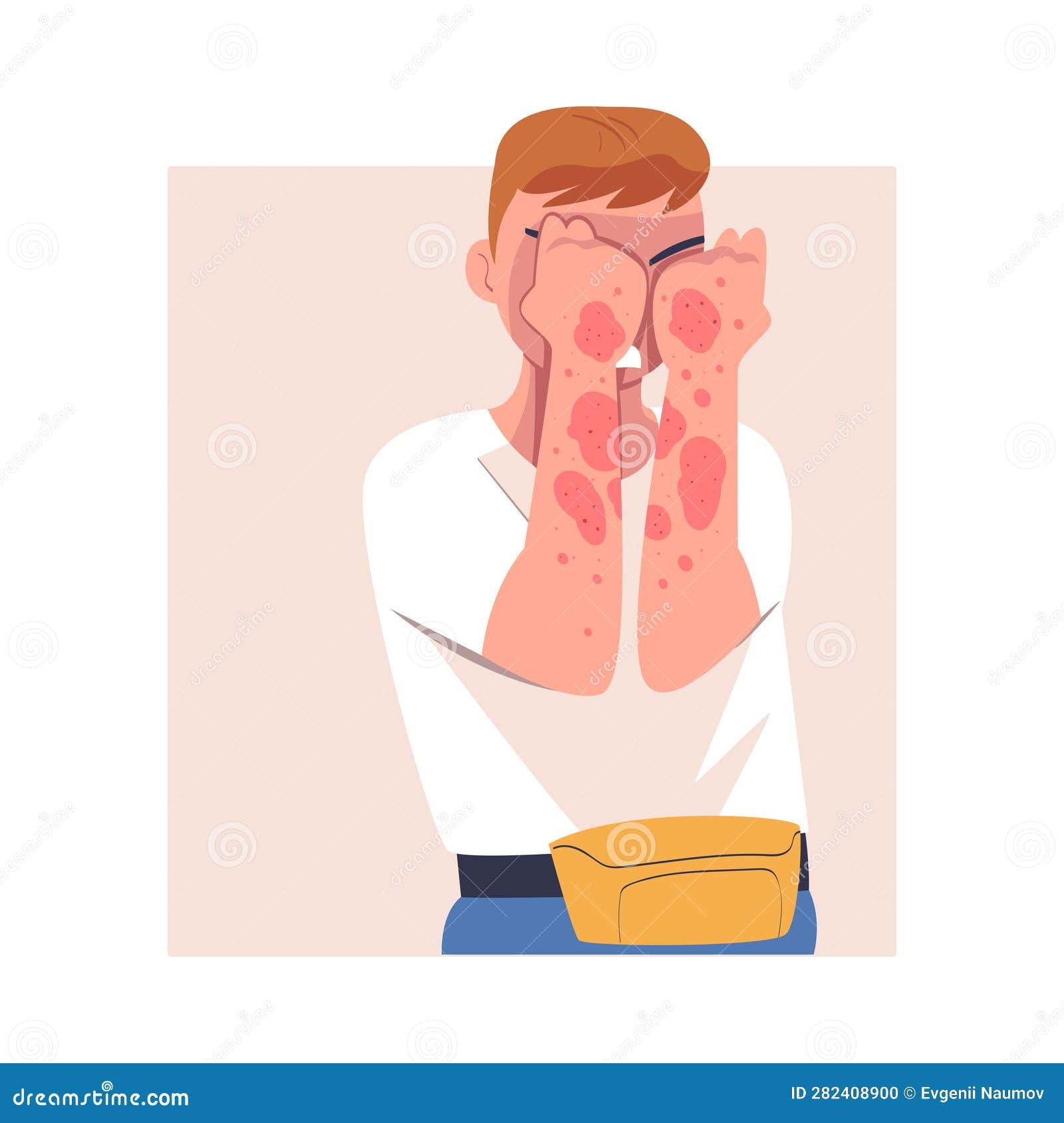 Sad Man Suffering From Psoriasis, Eczema Or Dermatitis Scratches Rashes ...