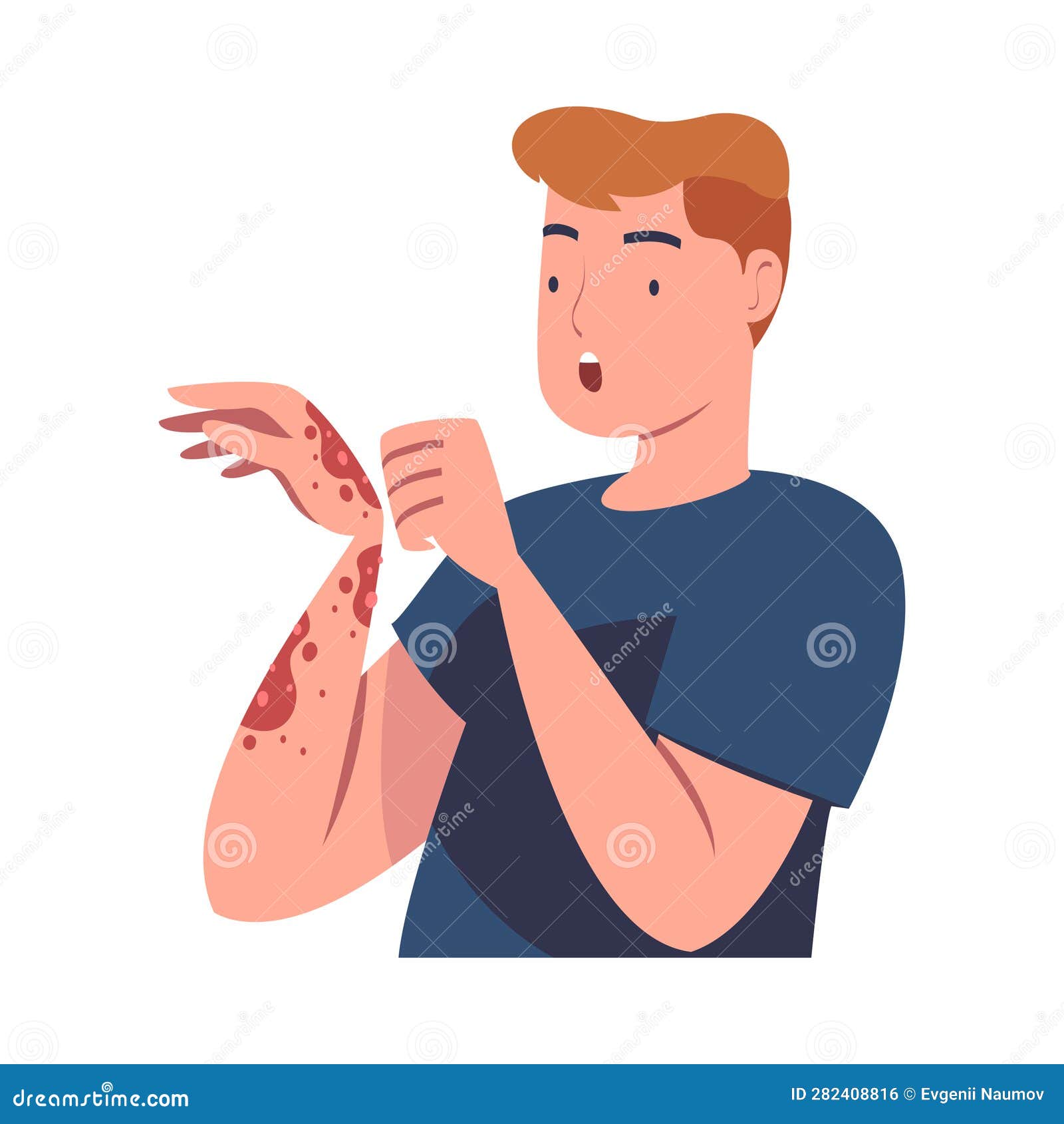 Man Character with Skin Problem Suffering Scratching Itching Arm Vector ...