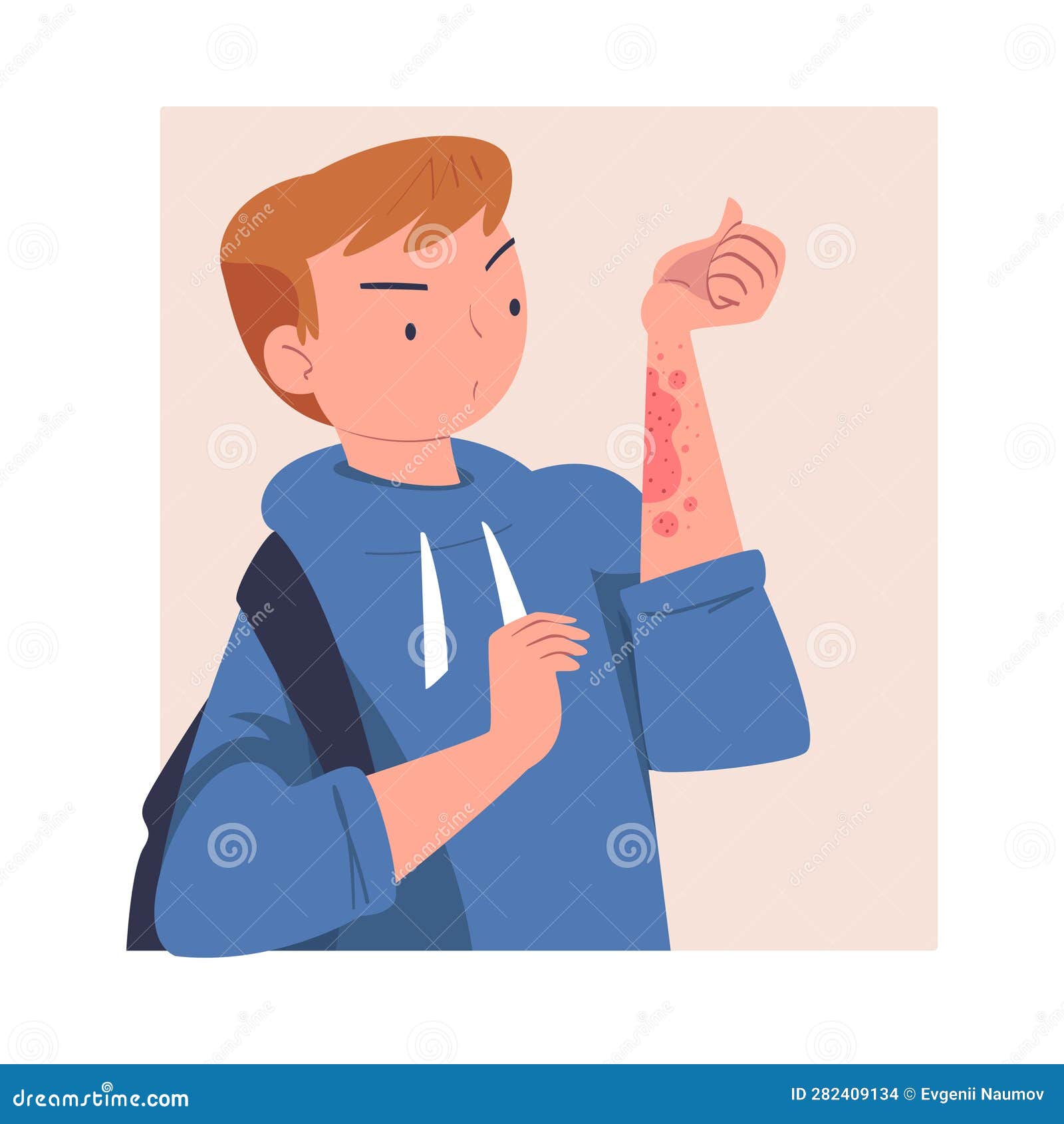 Man Scratching Itching Rash On His Body Vector Illustration ...