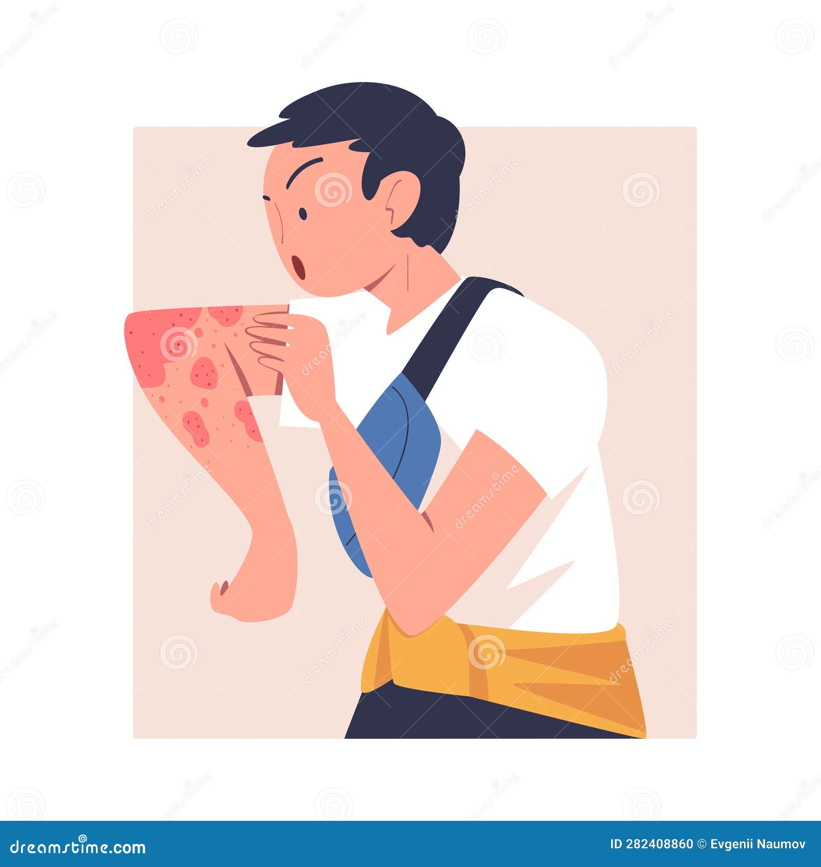 Man Character with Skin Problem Suffering Scratching Itching Elbow ...