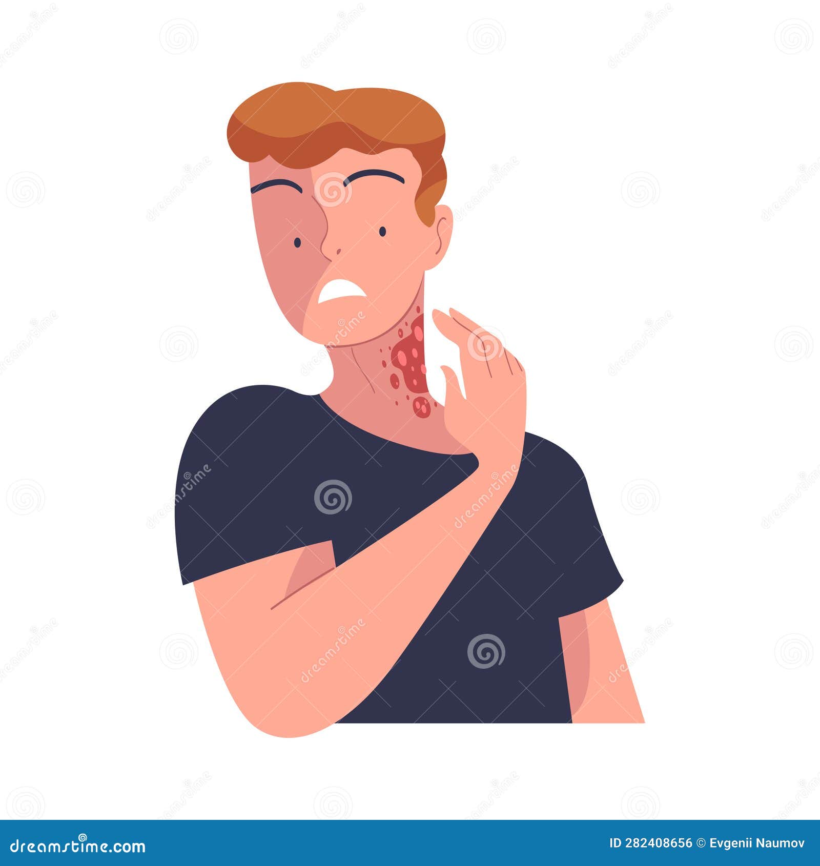 Man Character with Skin Problem Suffering Scratching Itching Neck ...