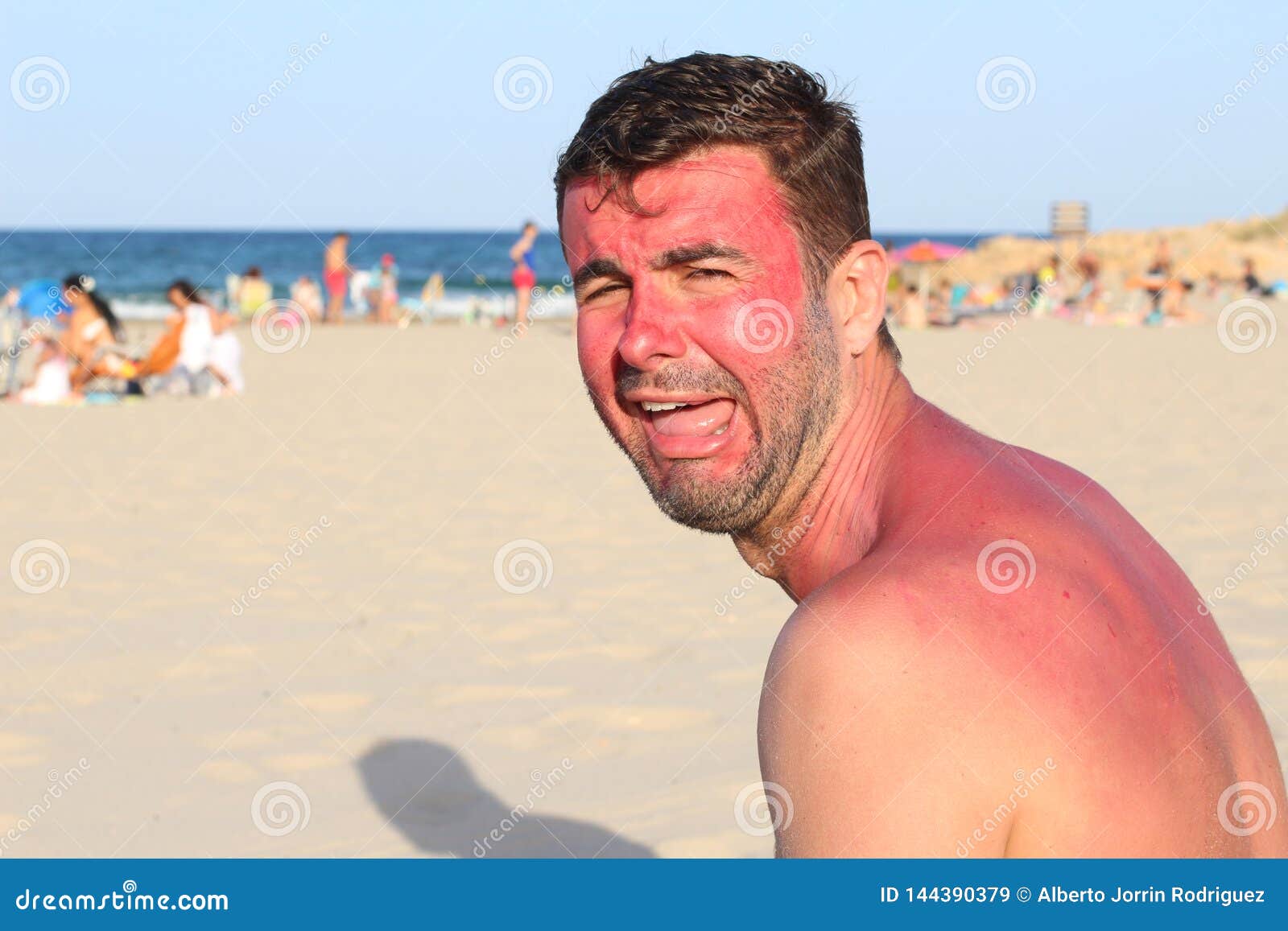 Man Crying after a Long Sun Exposure Stock Image - Image of careless ...