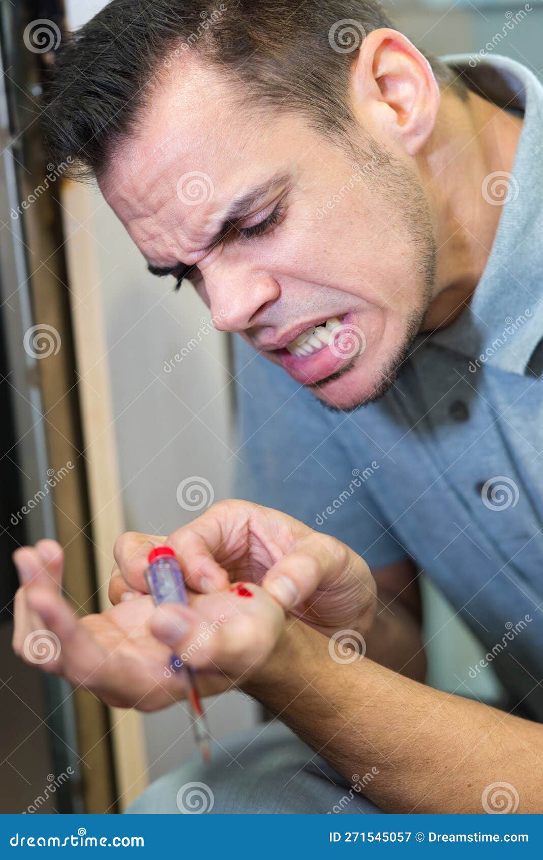 Man cut hand at work stock image. Image of tape, splatter - 271545057