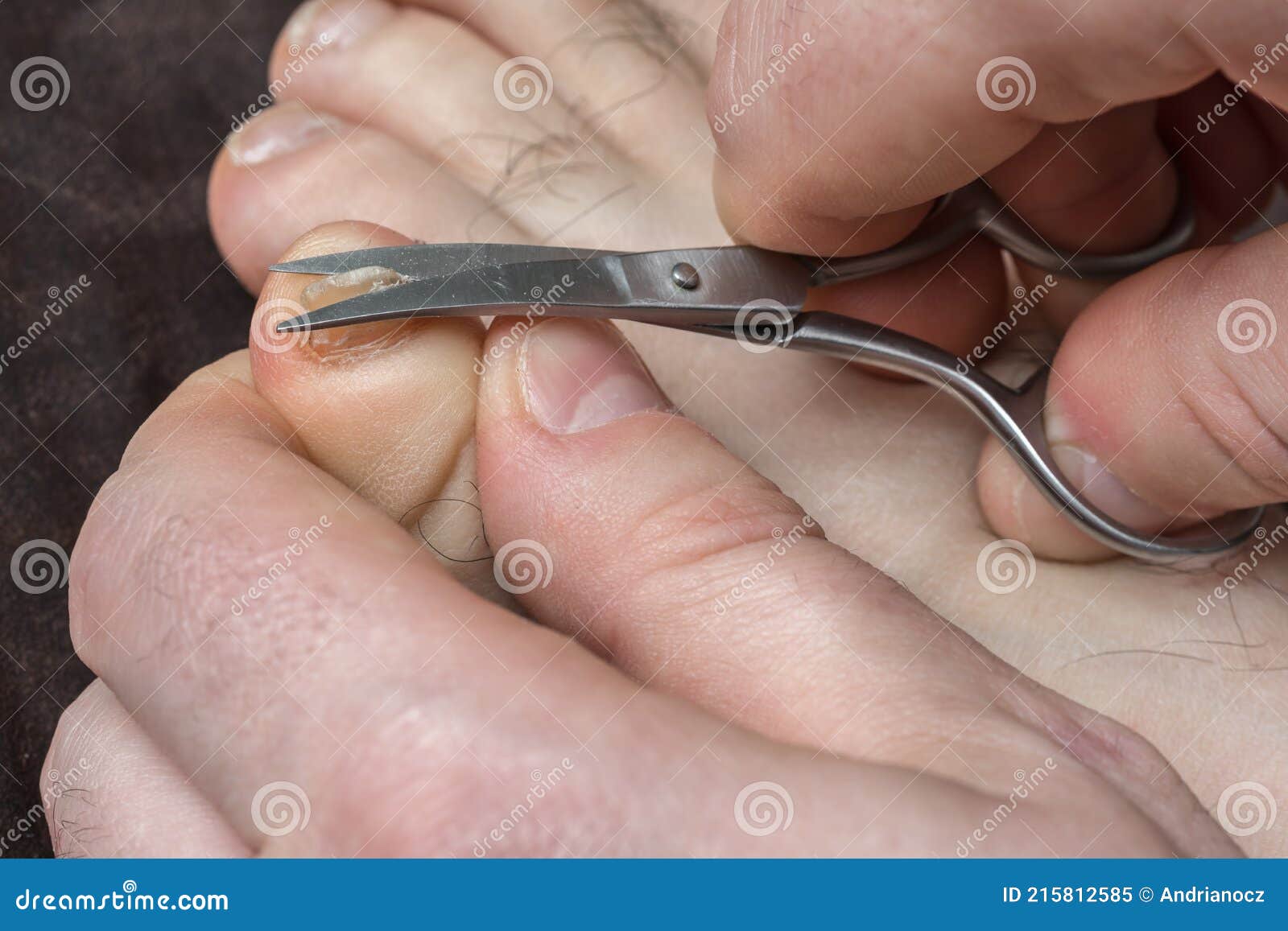 Man Cutting Nails on His Foot - Pedicure Stock Image - Image of remove ...