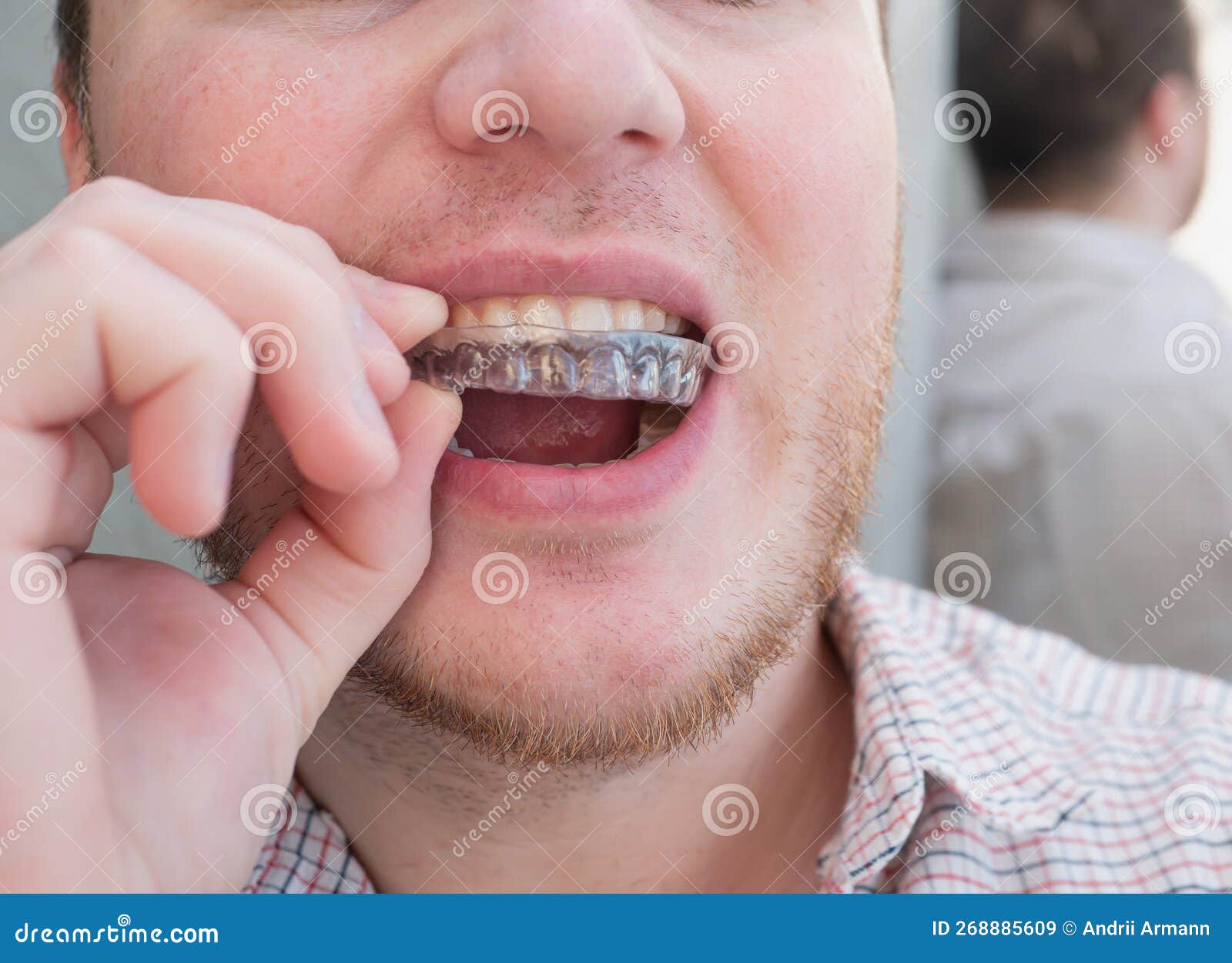 A Man Demonstrates Putting on a Plastic Aligner Plate from Brcusism, a ...