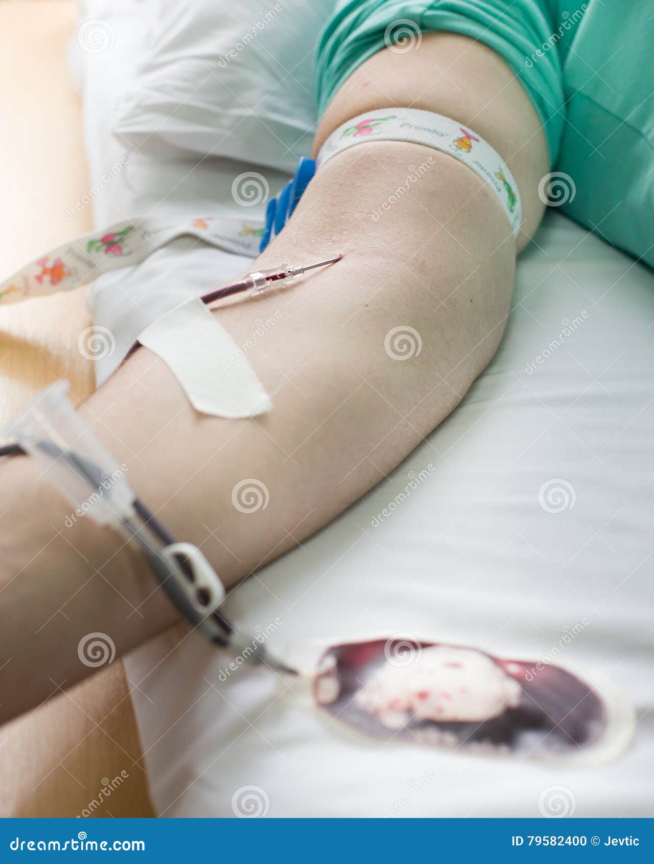Man donating blood stock photo. Image of clinic, hospital - 79582400