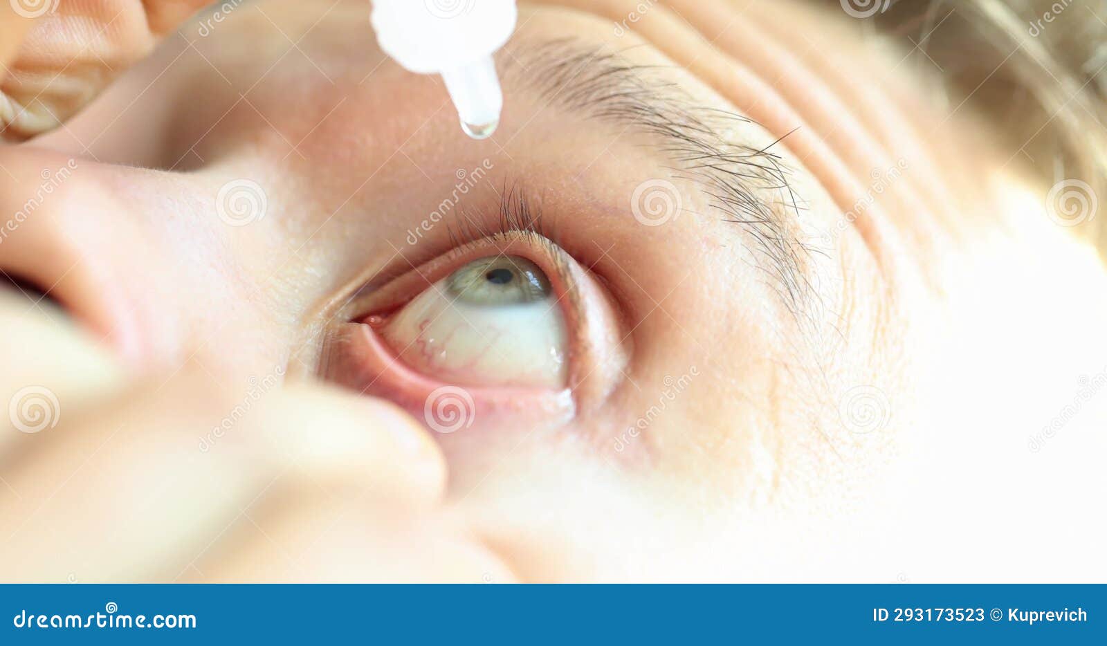 Man Dripping Liquid Drops into Dry Eyes Stock Video - Video of solving ...