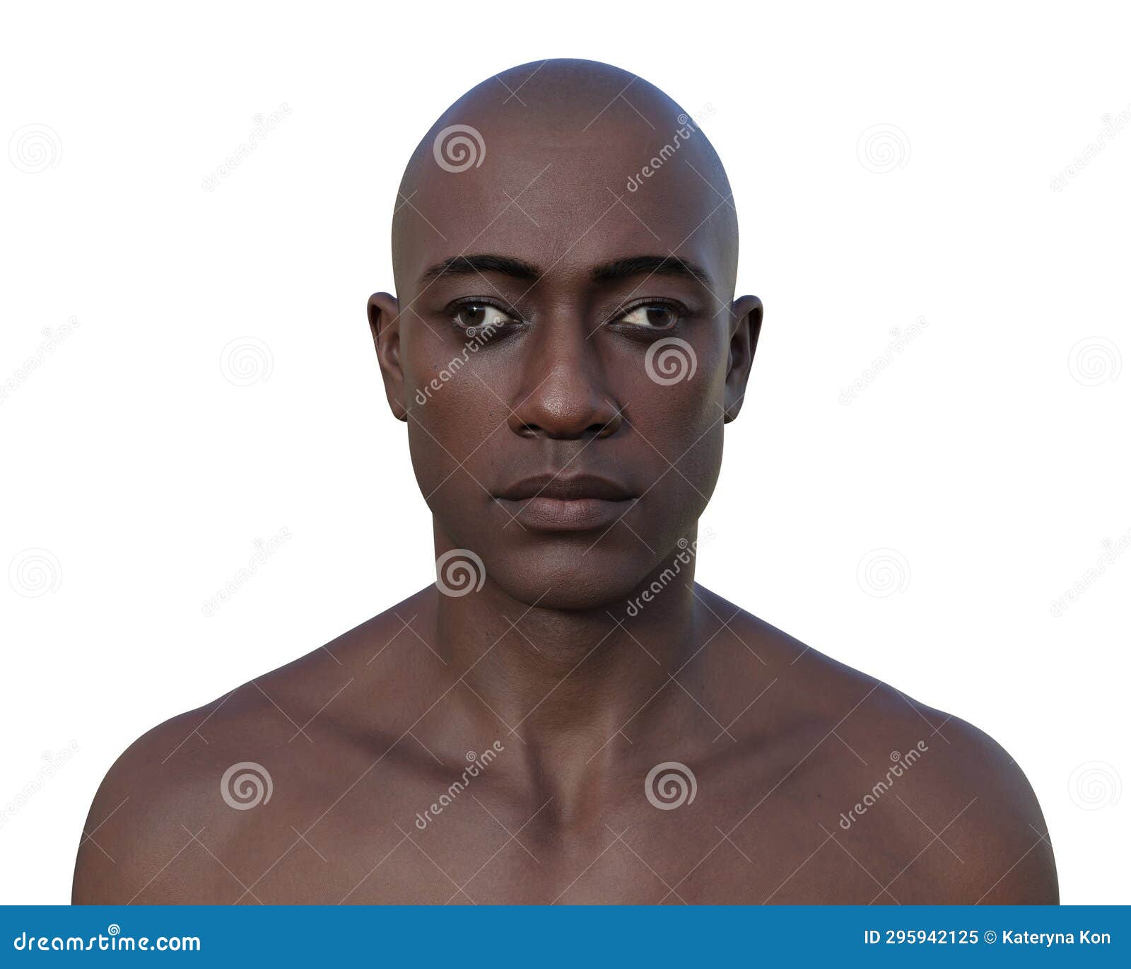 A Man with Exotropia, 3D Illustration Stock Illustration - Illustration ...