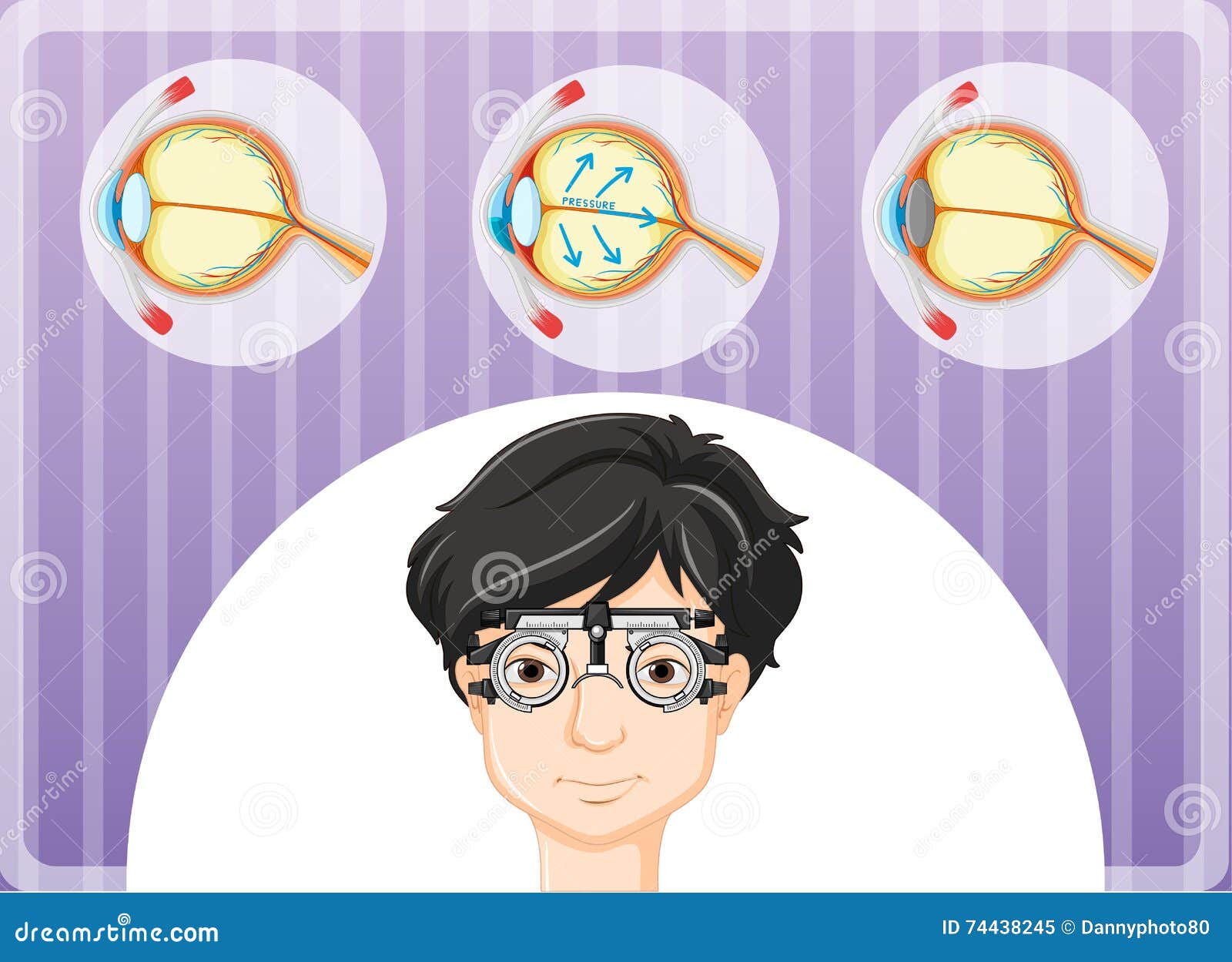Man with Eyeglasses and Eyes Problem Stock Vector - Illustration of ...