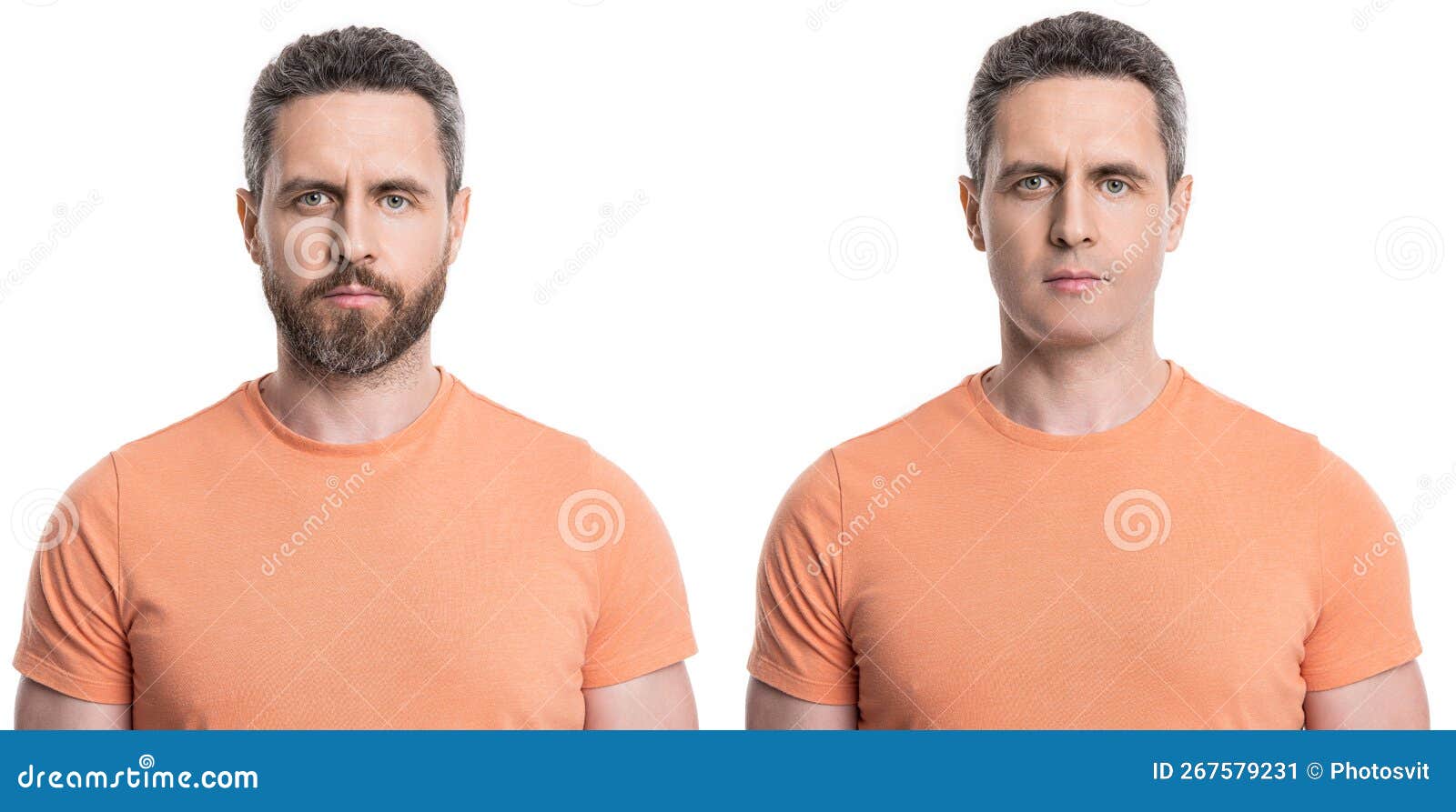 Man Face Stubble Comparison before and after in Studio. Man Face ...