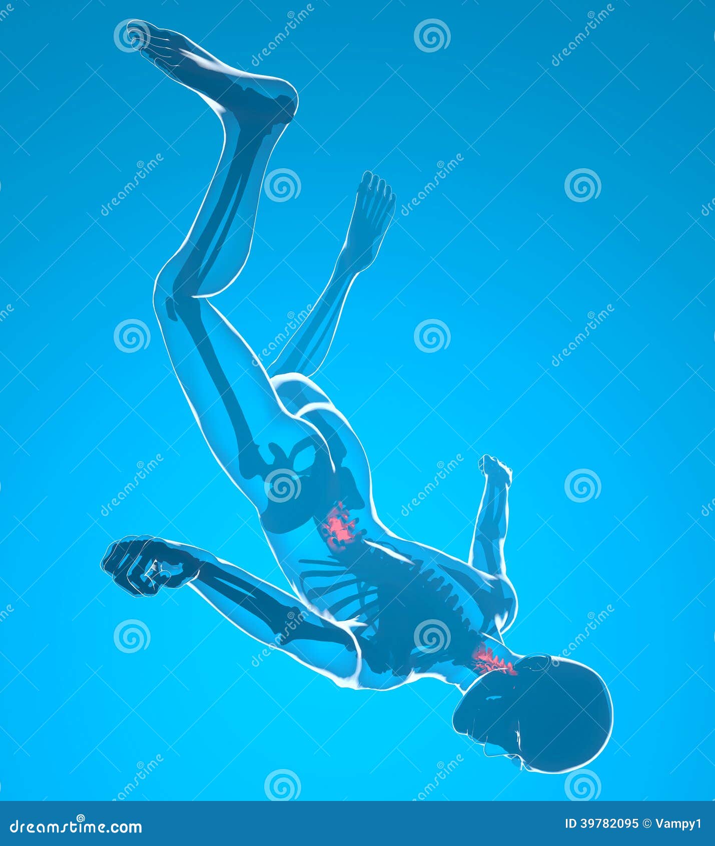Man falls seen on x-rays stock illustration. Illustration of body ...
