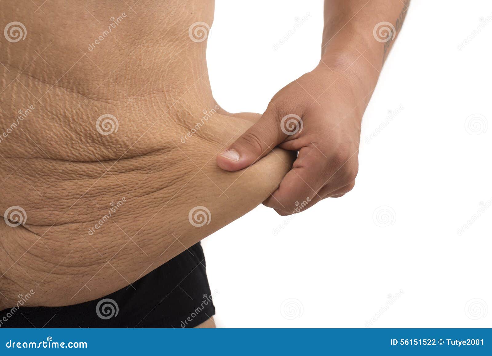 Man with Fat Belly and Stretch Marks Isolated Stock Photo - Image of ...