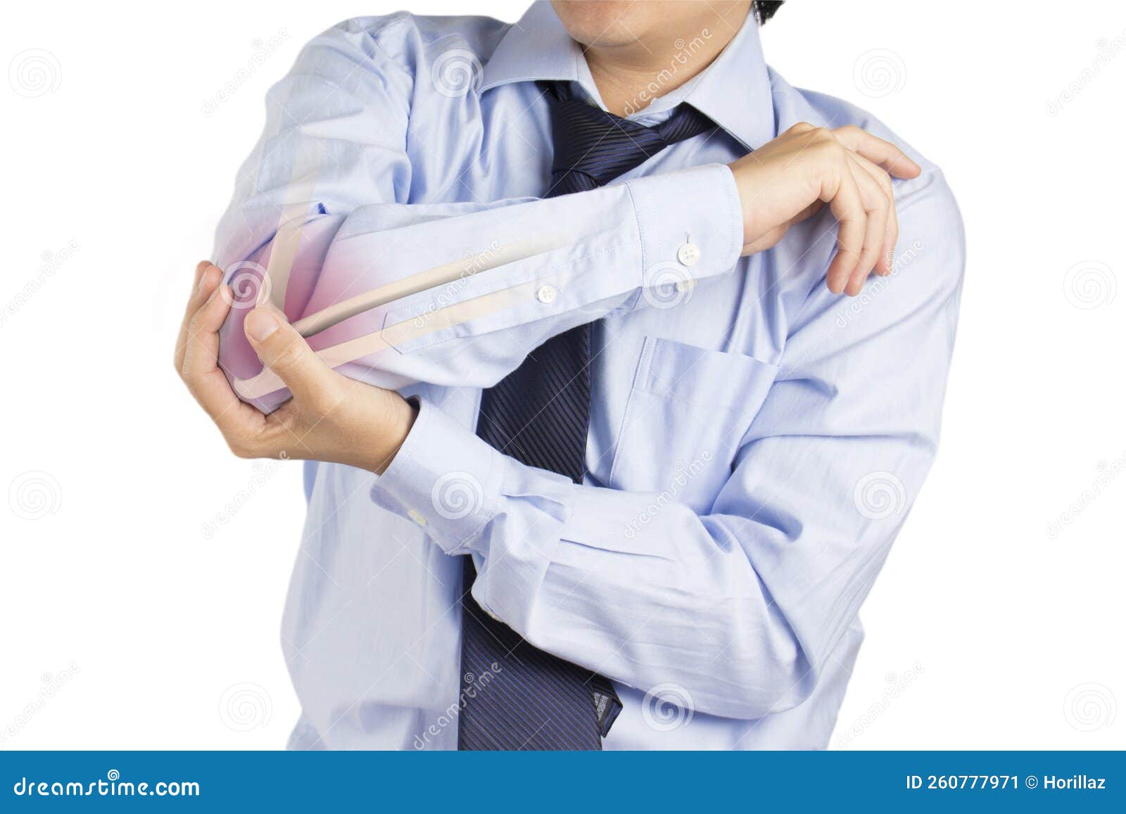 Elbow Bone Fracture Royalty-Free Stock Photography | CartoonDealer.com ...