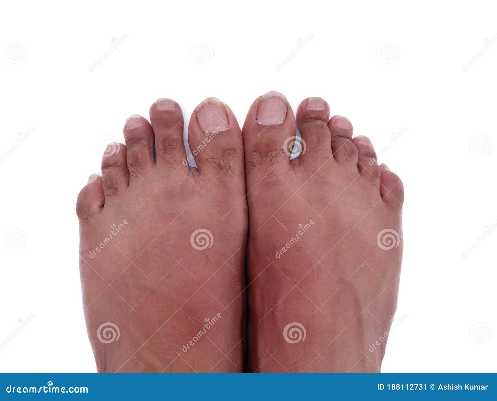 Man Feet Selfie Top View on White Background Isolated. Stock Image ...