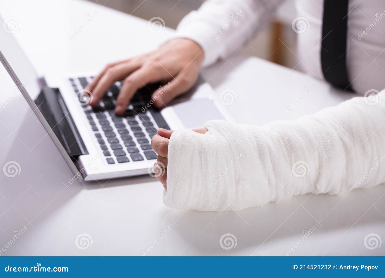 Man with Fractured Hand Using Laptop Stock Photo - Image of health ...