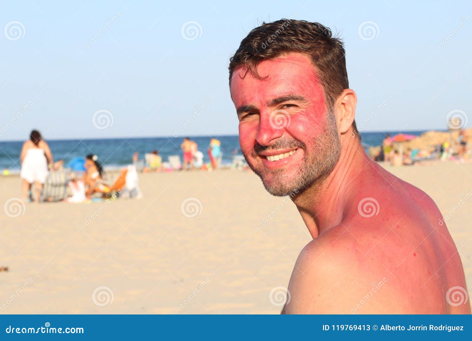 Man Getting Sunburned At The Beach Stock Image Image Of Sand Funny